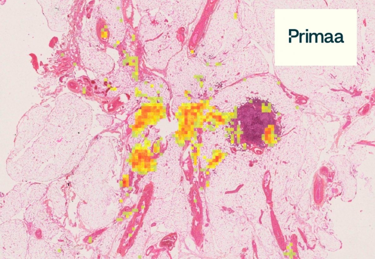 Des premiers fonds pour Primaa | CFNEWS